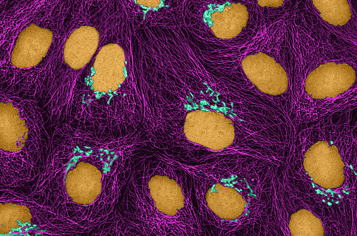 数百篇癌症论文提到了不存在的细胞系，为何会如此？ - 医咖会